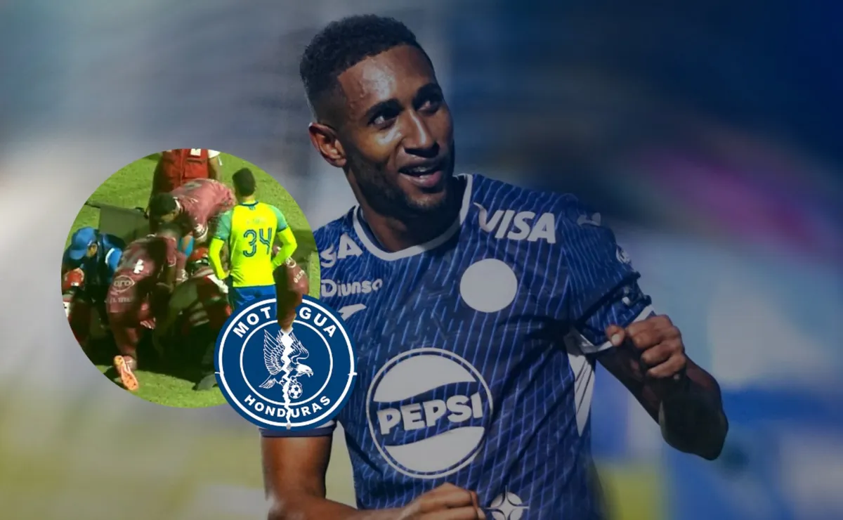 Motagua ya conoce la verdad sobre la terrible lesión de Romario Da Silva